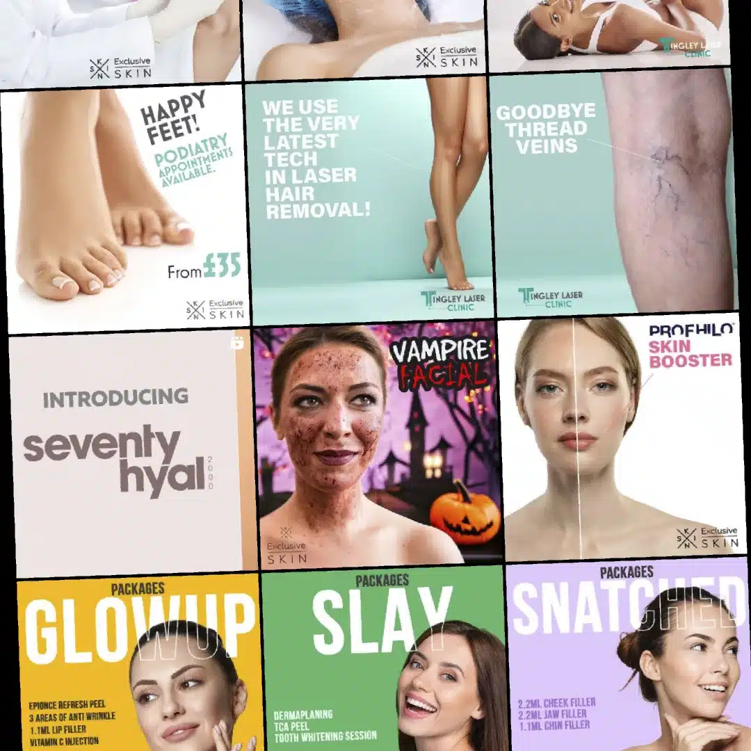 Exclusive Skin & Tingley Laser Social Media - Diablos Designs